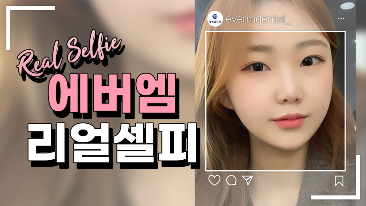 [RealSelfie] 양악수술 + 브이라인 + 광대축소 – 에버엠치과의원
