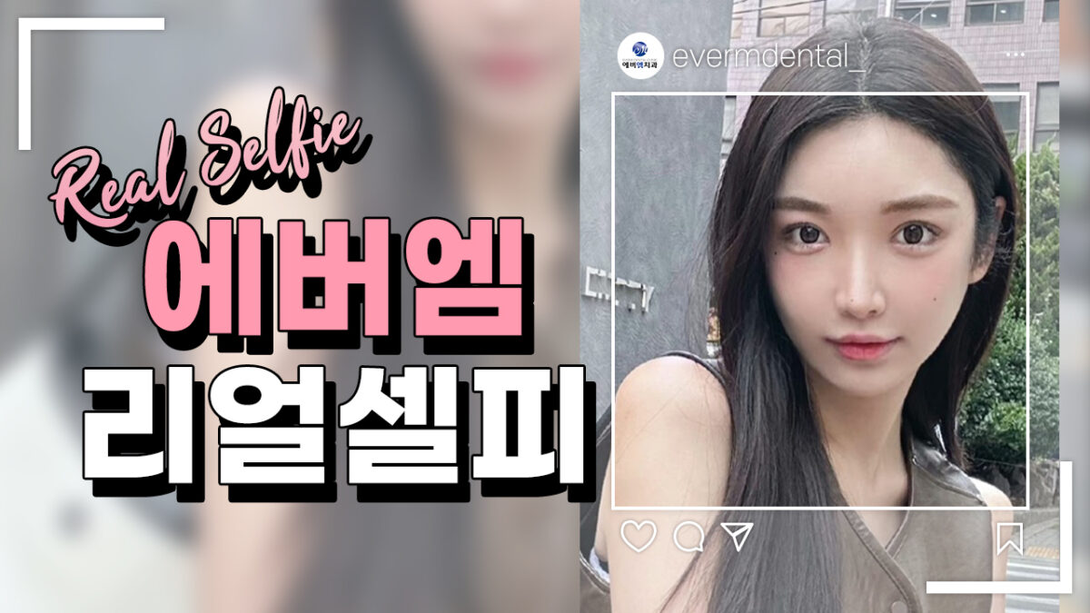 [RealSelfie] 양악수술 + 윤곽3종수술 – 에버엠치과의원
